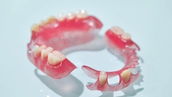 What Is a Partial Denture? Guide to Types and Uses
